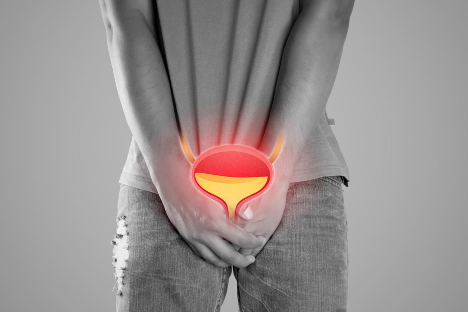 ¿Cómo se hace el examen de urodinamia? - Urointegral